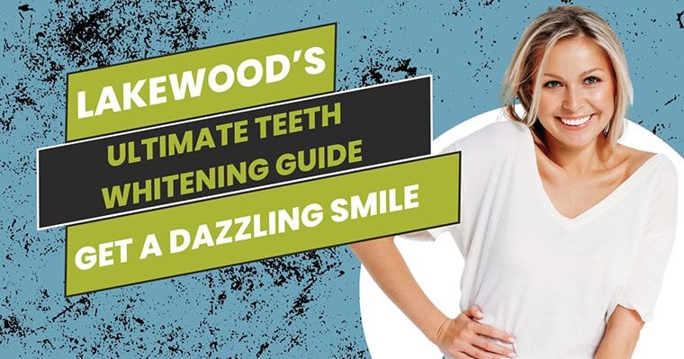 Lakewood’s Ultimate Teeth Whitening Guide: Get a Dazzling Smile Lakewood’s Ultimate Teeth Whitening Guide: Get a Dazzling Smile